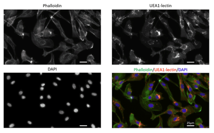 Automated Immunofluorescence using a sequential flow injection system